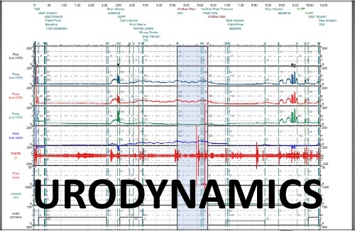 Demystifying Urodynamics Testing: An In-depth Look