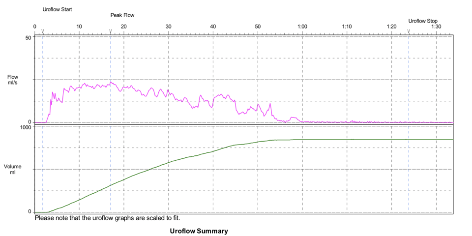 How Can We Maximize The Diagnostic Utility Of Uroflow?
